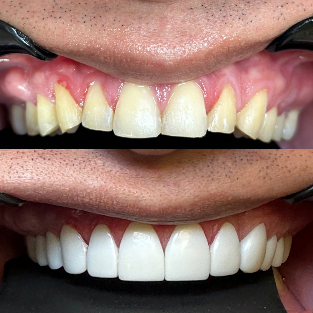 SMILE DESIGN – Viviana patiño Spa